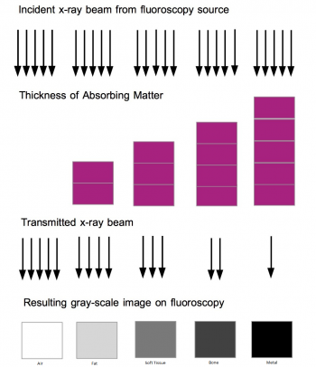 Fluoroscopy – Undergraduate Diagnostic Imaging Fundamentals